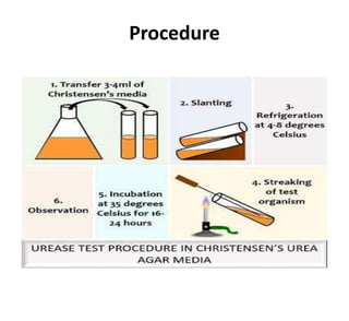 1.Catalase,urease and TSI Test.pptx