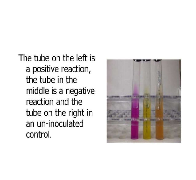 1.Catalase,urease and TSI Test.pptx