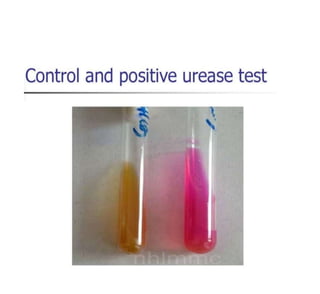 1.Catalase,urease and TSI Test.pptx