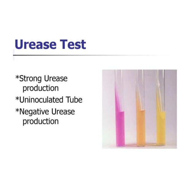 1.Catalase,urease and TSI Test.pptx