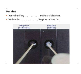 1.Catalase,urease and TSI Test.pptx
