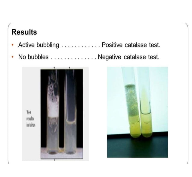 1.Catalase,urease and TSI Test.pptx