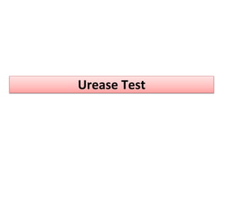 1.Catalase,urease and TSI Test.pptx