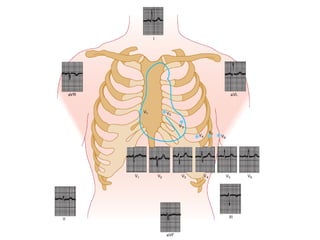 1.3.1.8 - Dasar-Dasar EKG.pdf