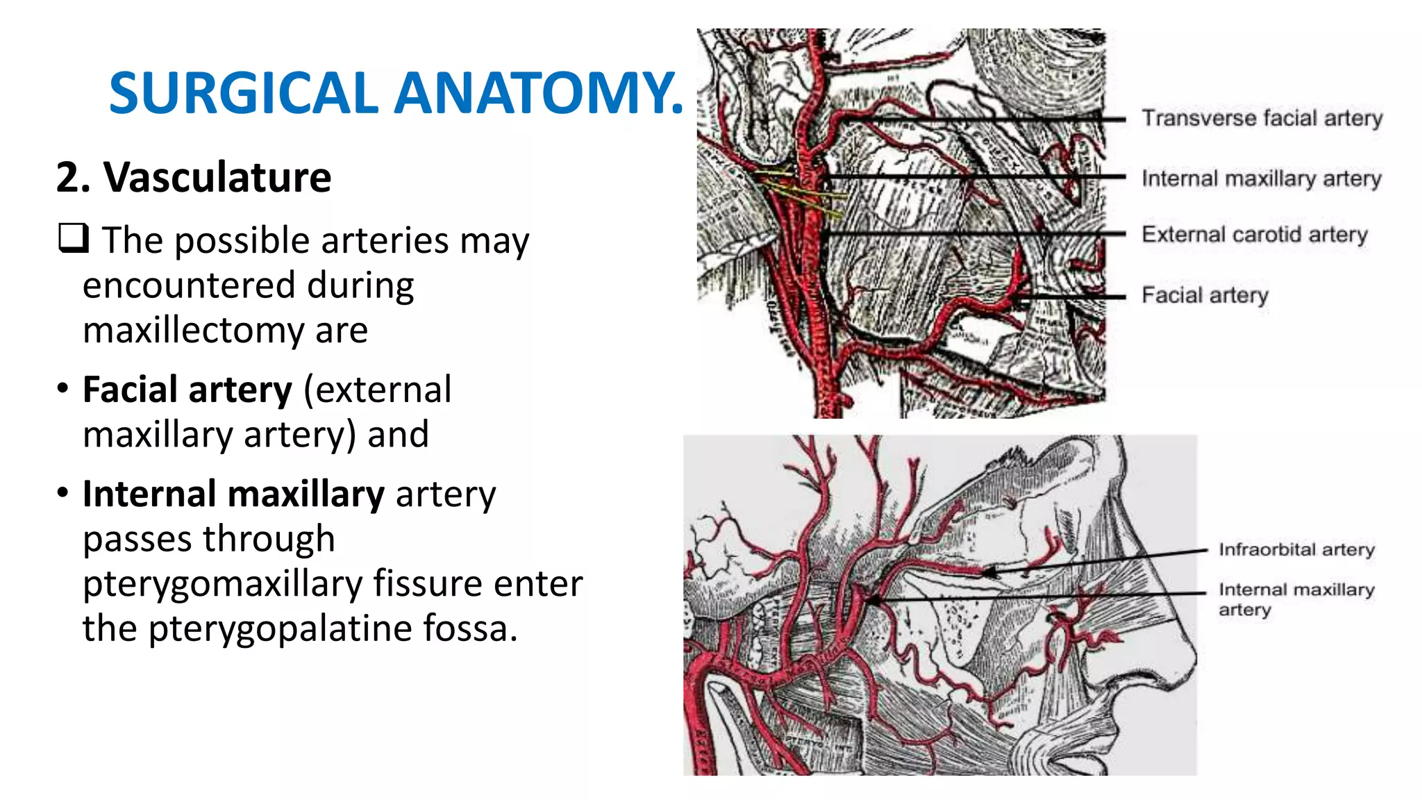 1. MAXILLECTOMY.pptx