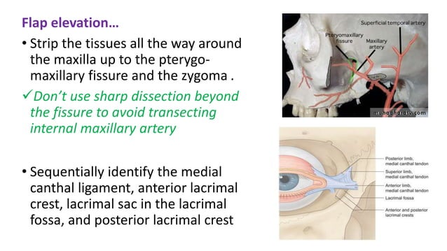 1. MAXILLECTOMY.pptx
