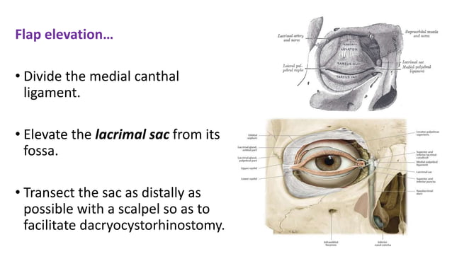 1. MAXILLECTOMY.pptx