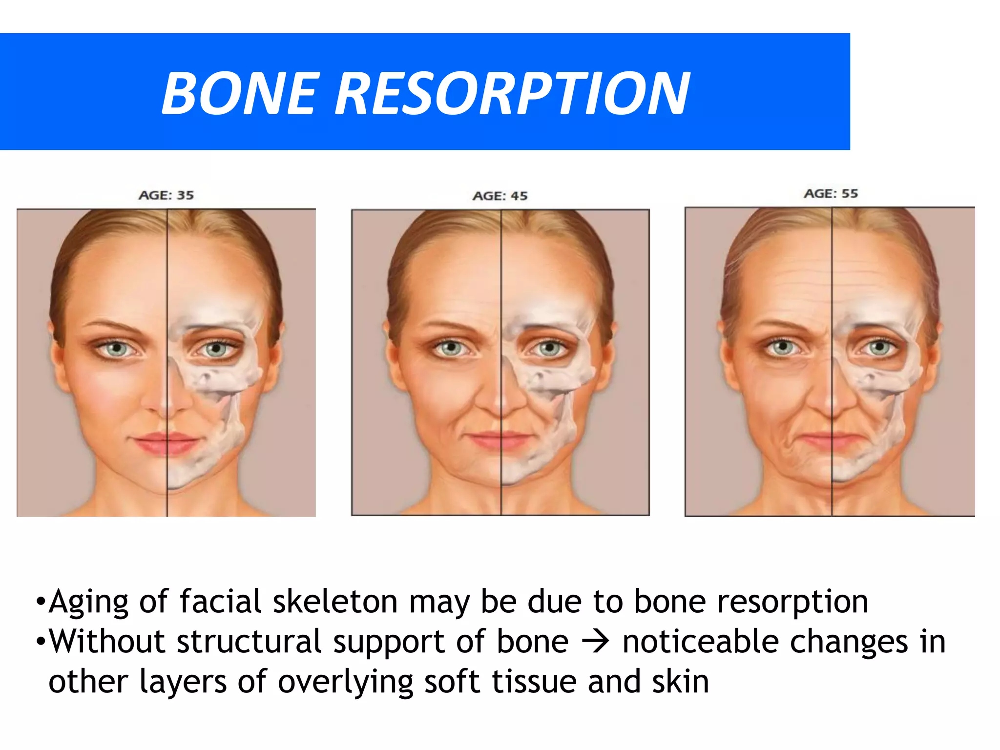 1. dr. Hendra - Basic Knowledge of The Wrinkles Final A .ppt.pdf