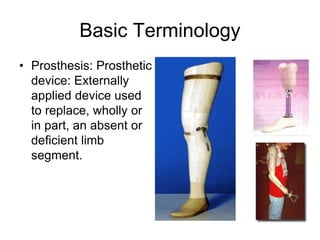 1.Introduction to P&O material-Teminilogy - presentation 2.ppt