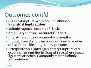 1. ECTOPIC PREGNANCY.ppt
