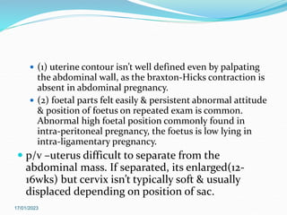 1. ECTOPIC PREGNANCY.ppt