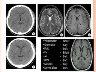 Basic about radiology & imaging.pdf