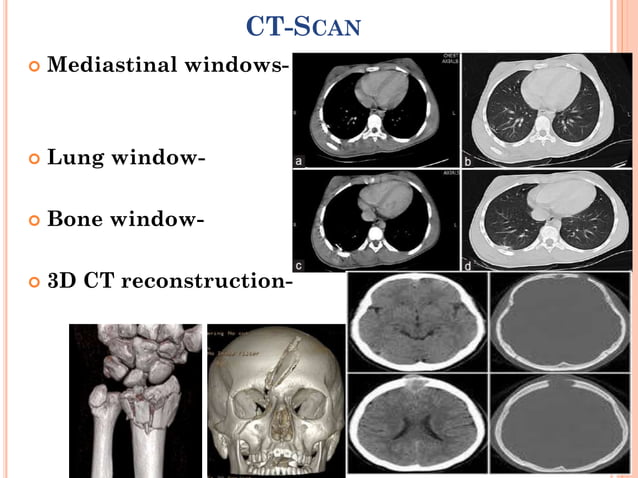 Basic about radiology & imaging.pdf