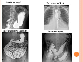 Basic about radiology & imaging.pdf