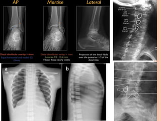 Basic about radiology & imaging.pdf