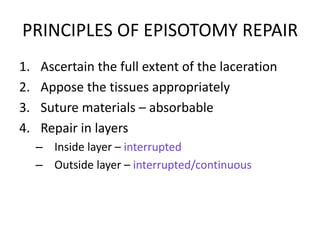 1. EPISIOTOMY.ppt