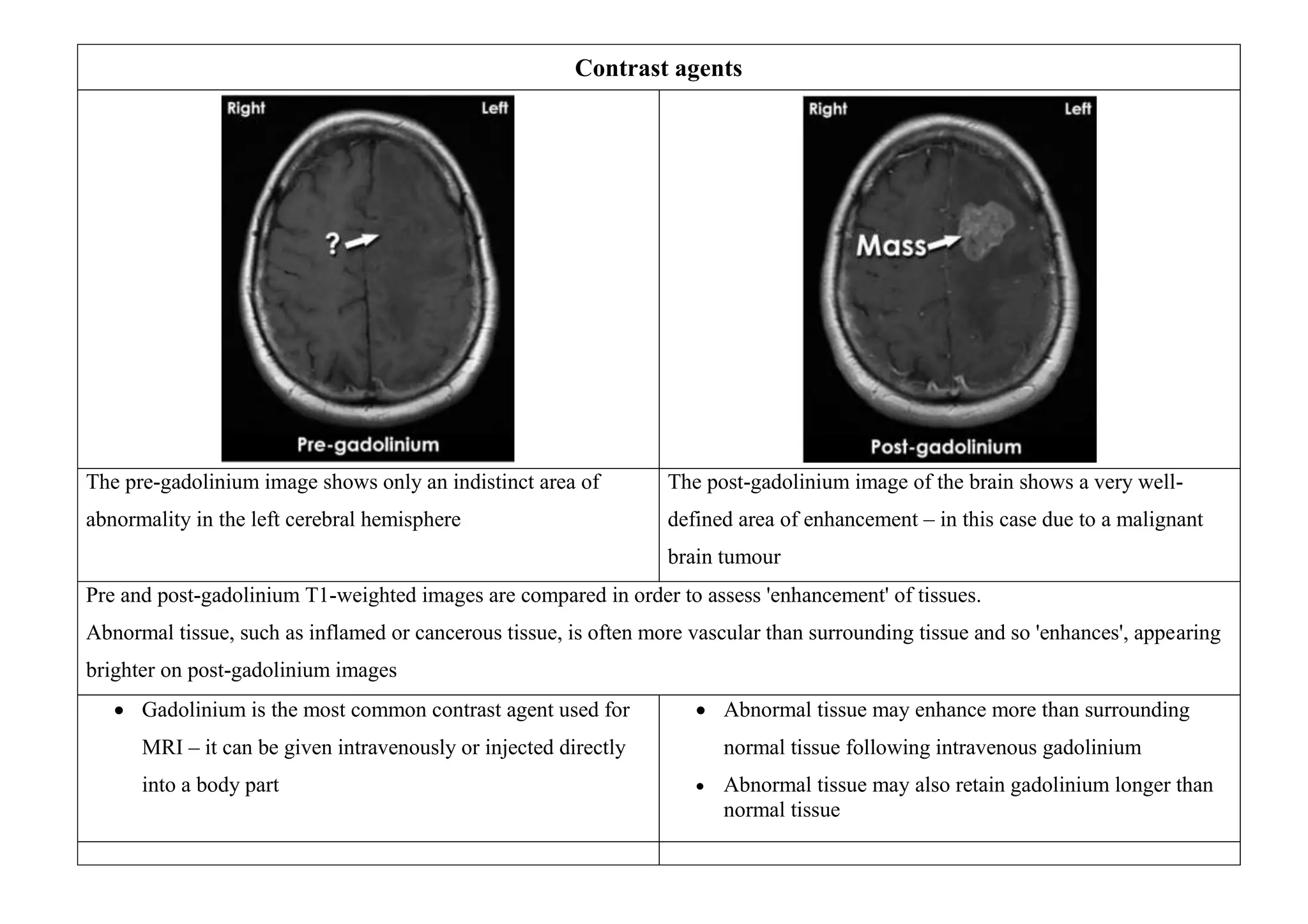 1. MRI interpretation.docx