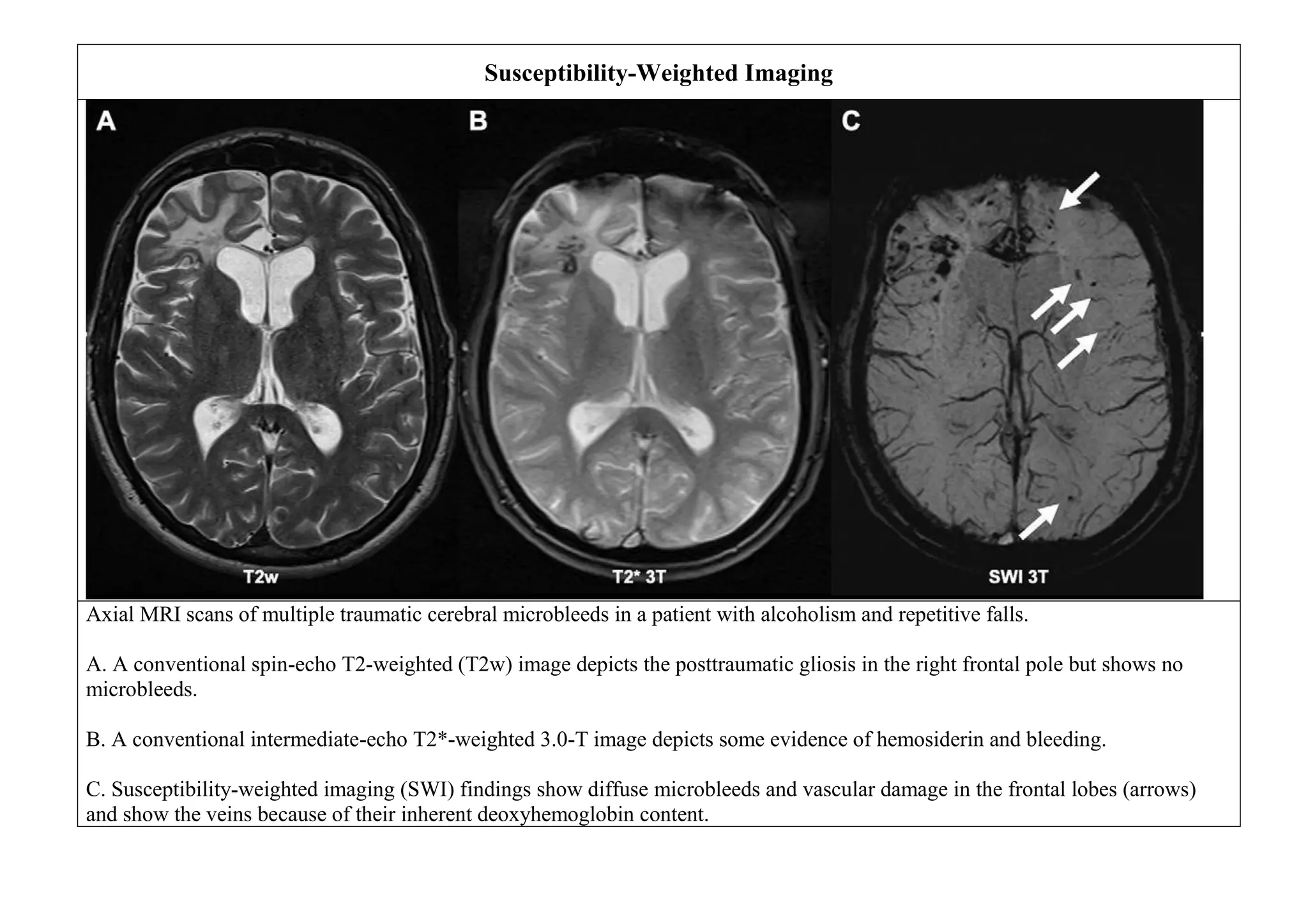 1. MRI interpretation.docx