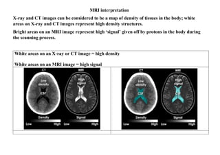 1. MRI interpretation.docx