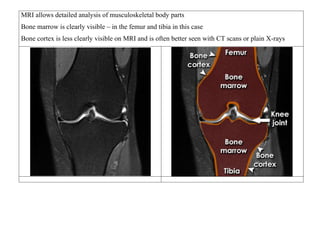 1. MRI interpretation.docx