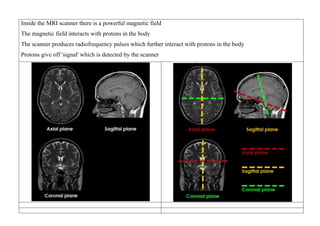 1. MRI interpretation.docx