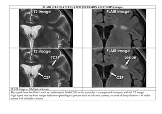 1. MRI interpretation.docx