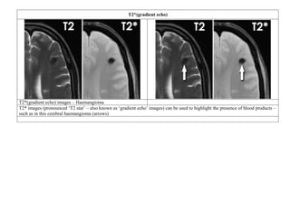 1. MRI interpretation.docx