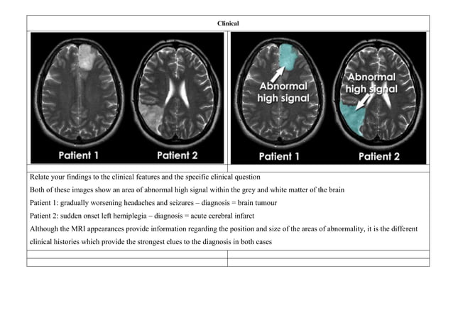 1. MRI interpretation.docx
