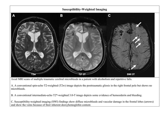1. MRI interpretation.docx
