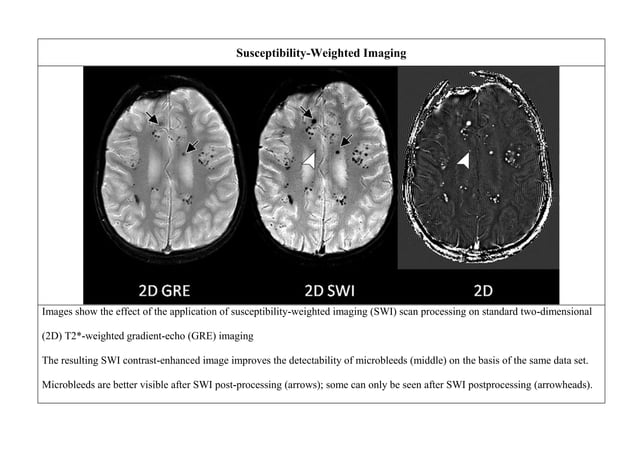 1. MRI interpretation.docx