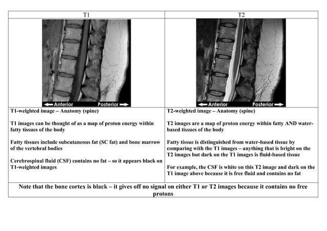 1. MRI interpretation.docx