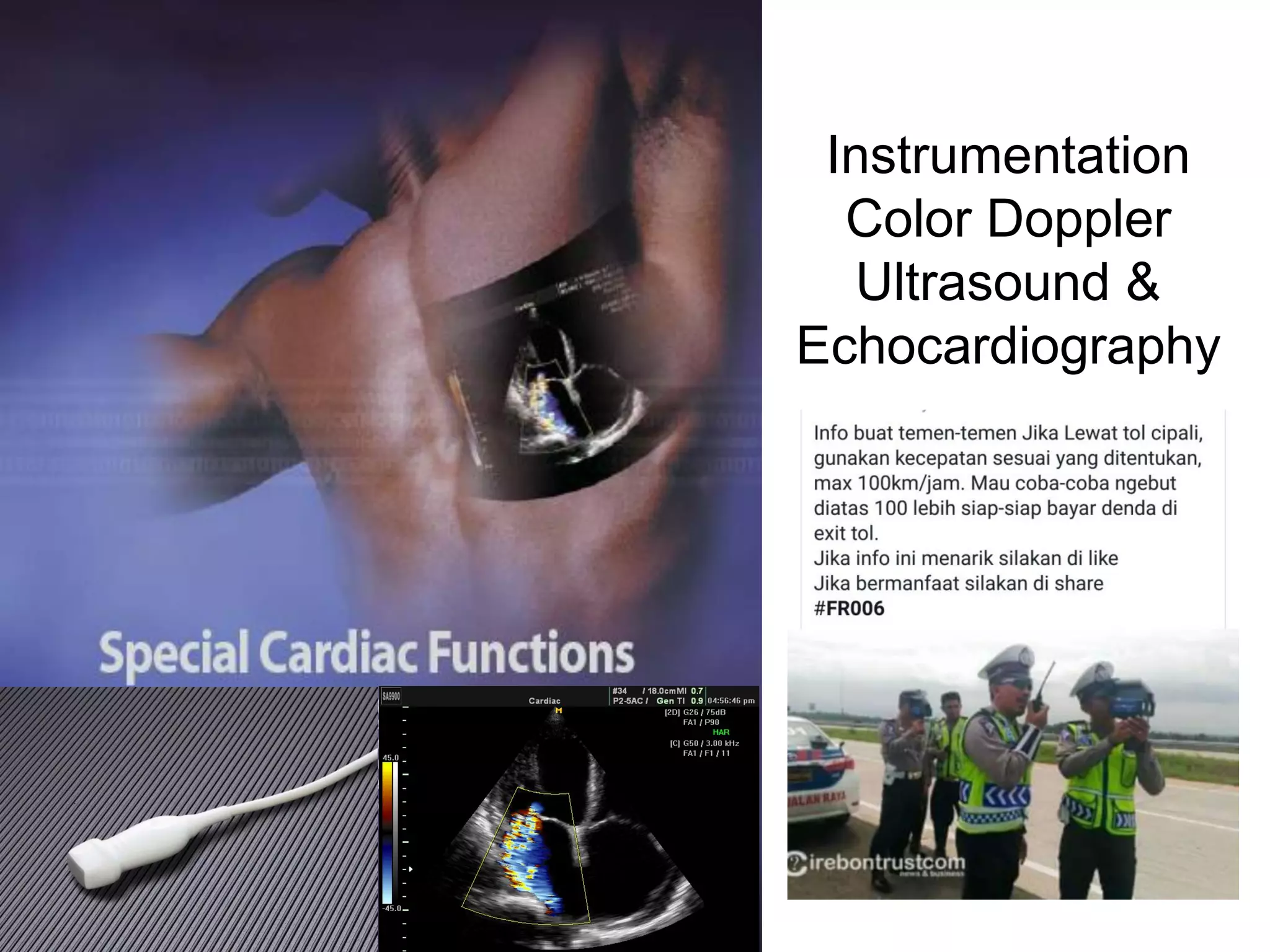 1. Echocardiogrphy Instrumentasi and color Doppler, Ir Cahyo.pdf
