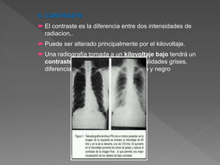 1. Fisica Rayos X.pptx
