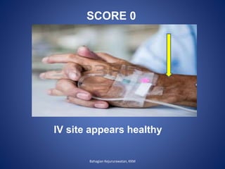 Recognising thrombophlebitis | PPTX