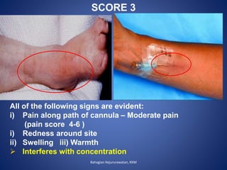 Recognising thrombophlebitis | PPTX