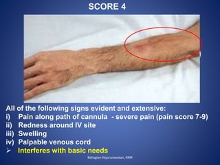 Recognising thrombophlebitis | PPTX