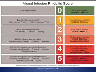 Recognising thrombophlebitis | PPTX