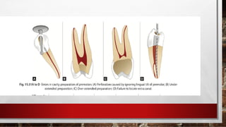 1._Access_cavity.pdf