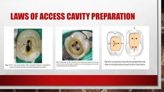 1._Access_cavity.pdf