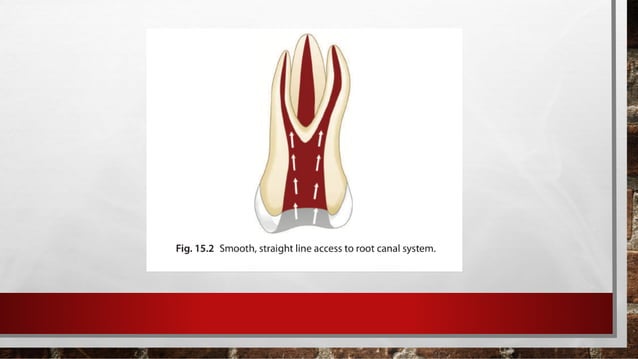 1._Access_cavity.pdf