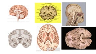 1. brain atlas.pdf