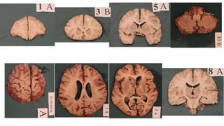 1. brain atlas.pdf