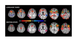 1. brain bee 概论 2022.pdf | Brain and Nervous System Disorders ...