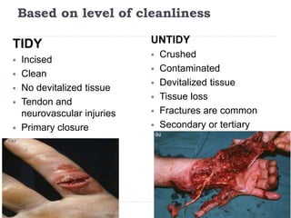 1.Wound healing.pptx