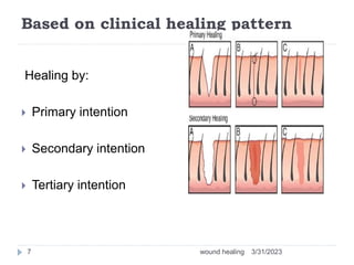 1.Wound healing.pptx