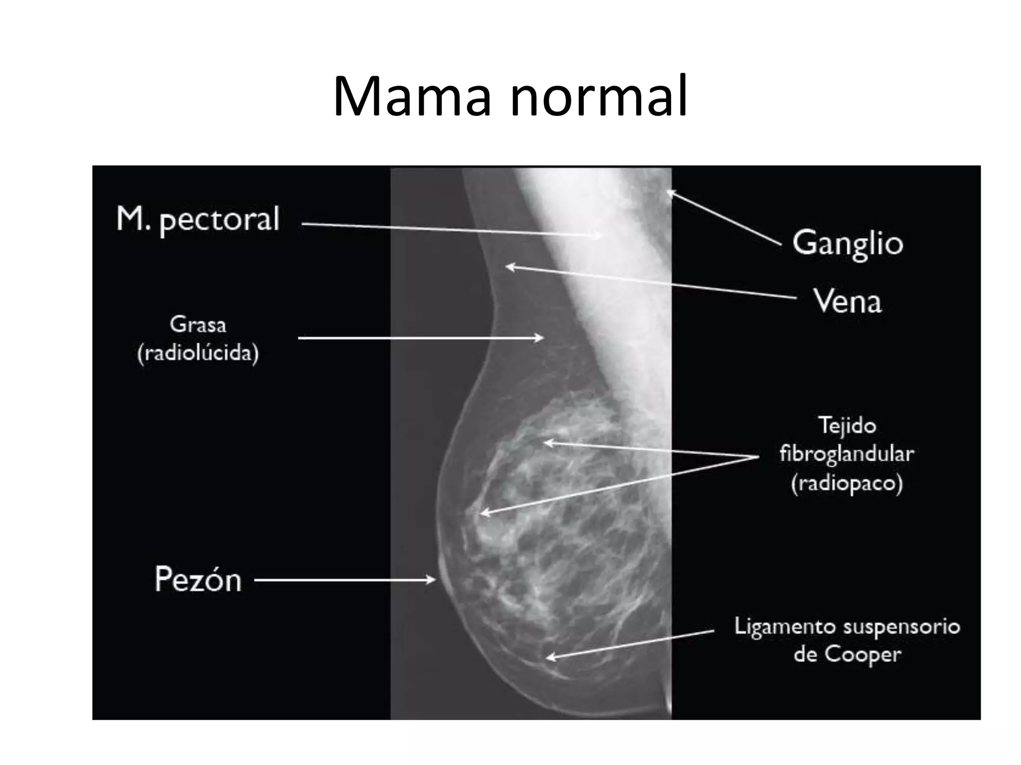 1. ANATOMIA DE MAMA CORRELACIÓN ANATÓMICA SESIÓN.pptx