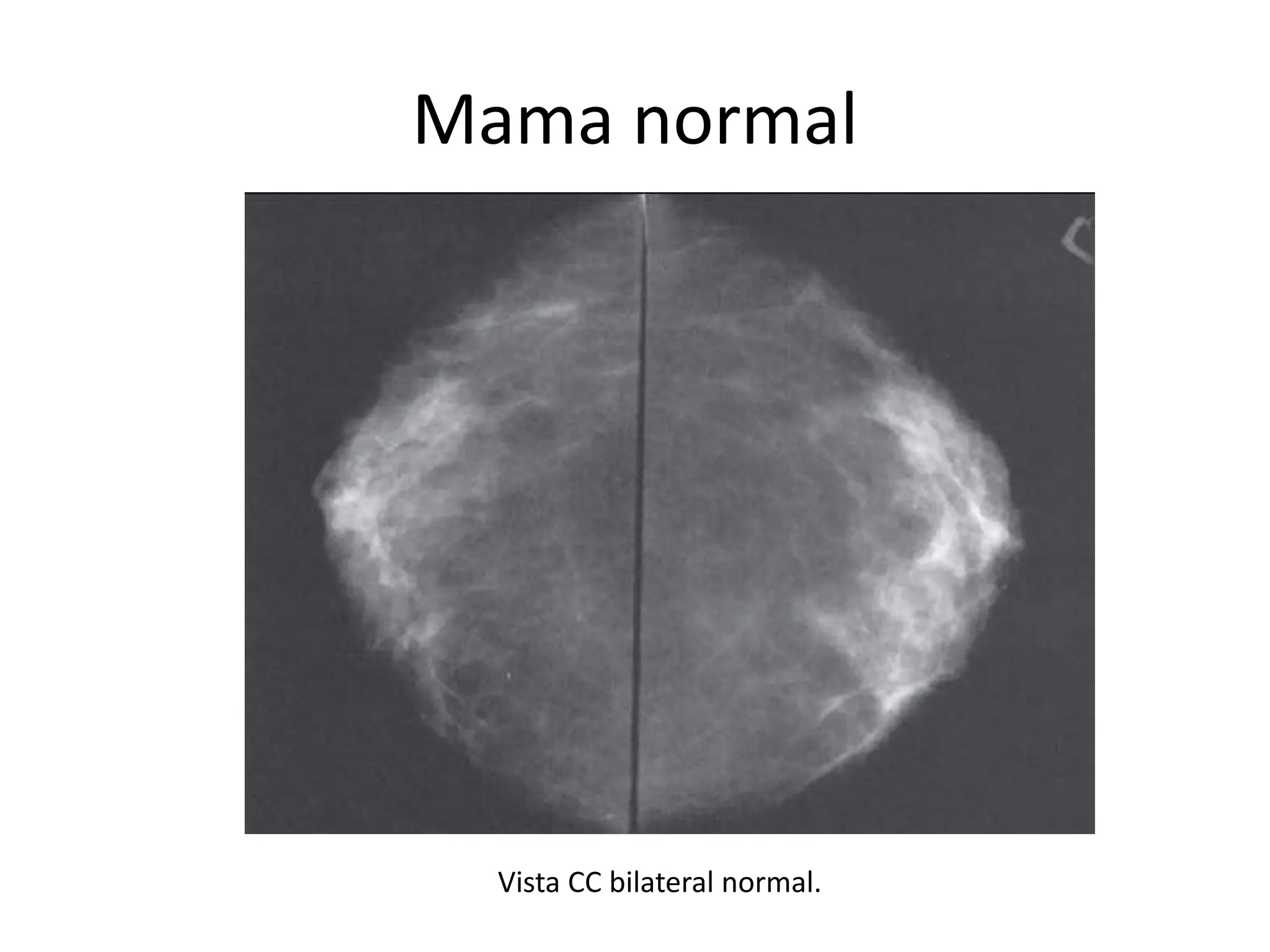 1. ANATOMIA DE MAMA CORRELACIÓN ANATÓMICA SESIÓN.pptx