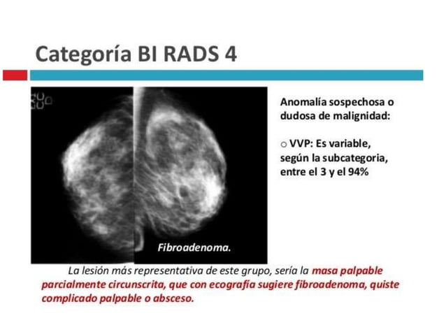 1. ANATOMIA DE MAMA CORRELACIÓN ANATÓMICA SESIÓN.pptx