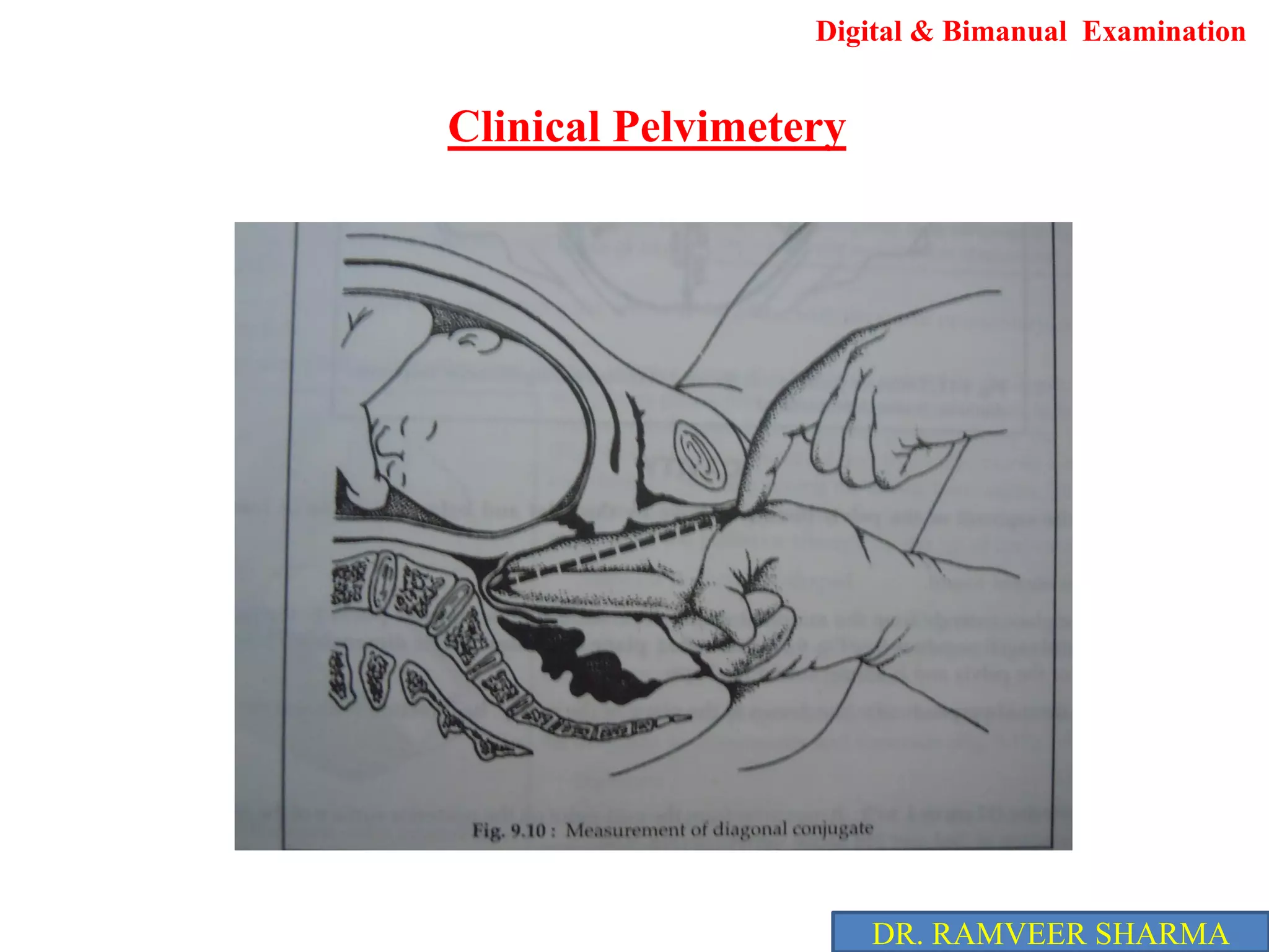 1.1 - Bimanual Examination in Gynae and Obstetrics.pdf