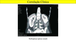 1. Sistema Urinário.pptx
